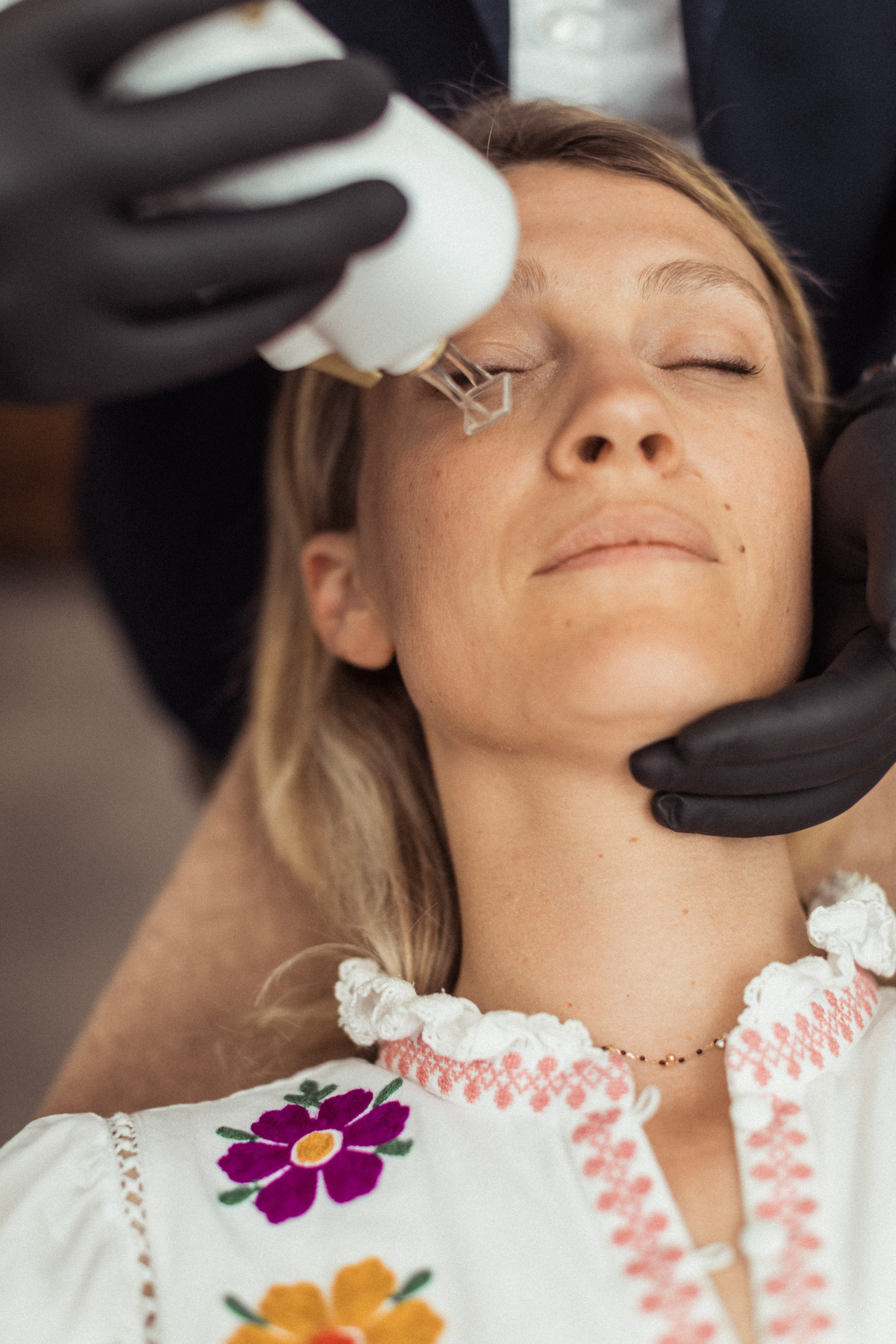 Blépharoplastie au laser : Alternative efficace à la chirurgie ? | Dr ...